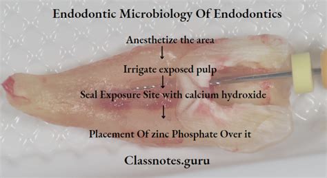 Endodontics Miscellaneous Question And Answers Class Notes