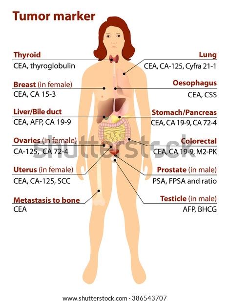 Tumor Marker Biomarker Stock Illustration 386543707 Shutterstock