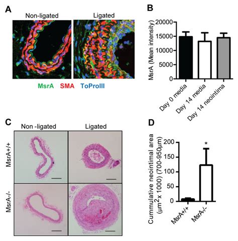 deletion of msra significantly increases neointimal formation a