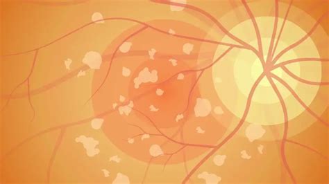 Dry Amd Decoded Your Guide To Clearer Vision