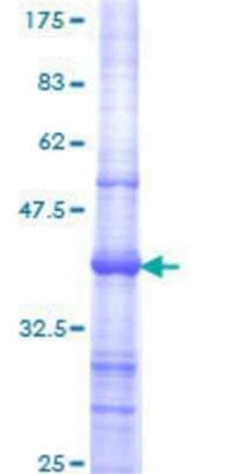 Novus Biologicals™ Recombinant Human Med16 Gst N Term Protein 10 μg