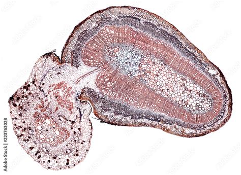 Cuscuta Stem And Median Cross Section Cut Under The Microscope