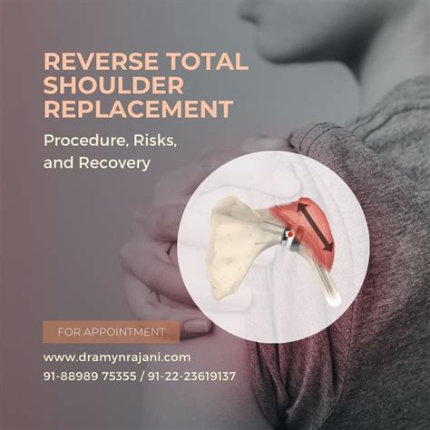 Reverse Total Shoulder Replacement Procedure Risks And Recovery