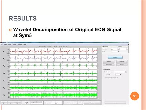 Ecg Beat Classification And Feature Extraction Using Artificial Neural