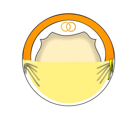 Wedding Button 2 Openclipart