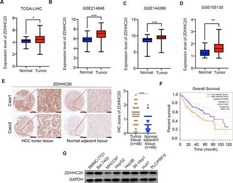 Figure 1 From Zdhhc20 Activates Akt Signaling Pathway To Promote Cell