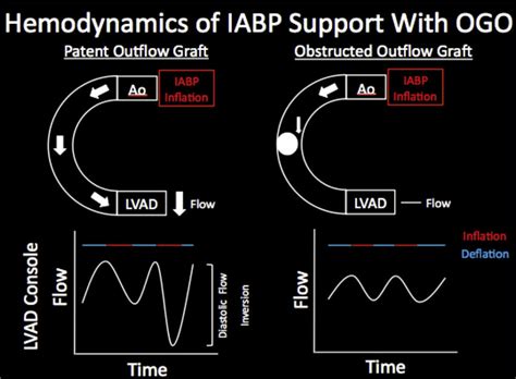 Hemodynamic Effects Of An Iabp Download Scientific Diagram