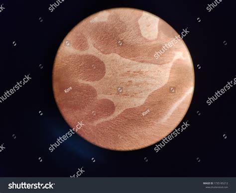 Fusarium Oxysporum Fungus Under Microscope Stock Photo 1735185212 Shutterstock