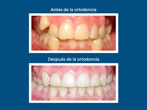 ¿cÓmo Saber Si Estamos En El Lugar Correcto Para Tu Tratamiento De