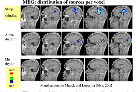 Figure 1 From Functional Localization Of Brain Sources Using Eeg Andor Meg Data Volume
