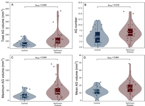 Intravenous Arachnoid Granulation Hypertrophy In Patients With Parkinson Disease Valiant