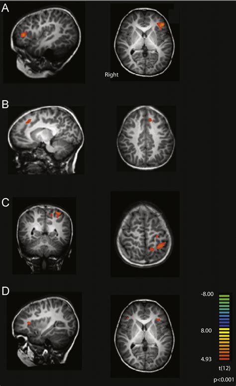 Figure 3 From The Effects Of Handwriting Experience On Functional Brain Development In Pre