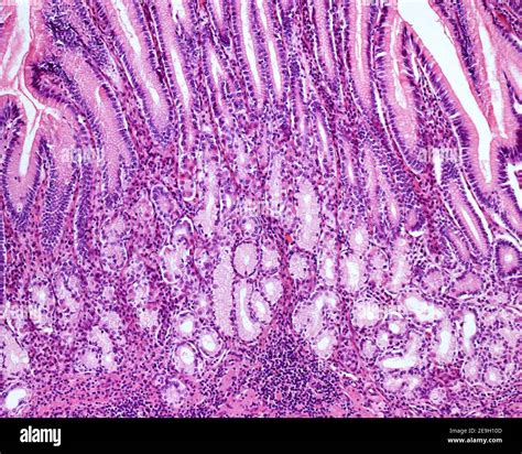 Stomach Histology Parietal Cells