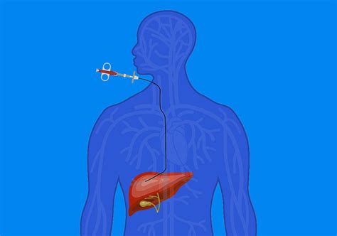Liver Biopsy Gastro Associates