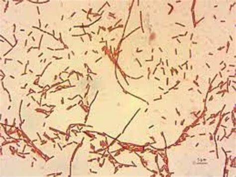 Probiotics Probiotic Bifidobacterium Bifidum Manufacturer From Bengaluru