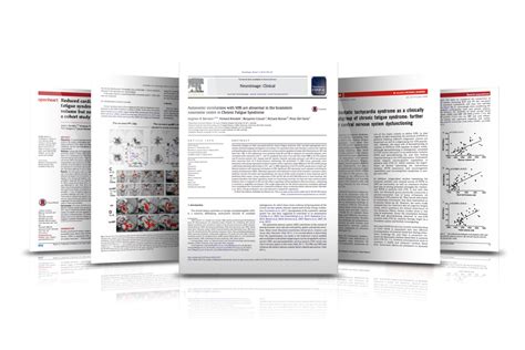 Autonomic Dysfunction Pots Studies — Me Education Research