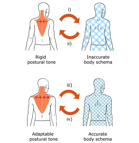 Why Your Map Matters Body Schema And Postural Tone Bristol Alexander