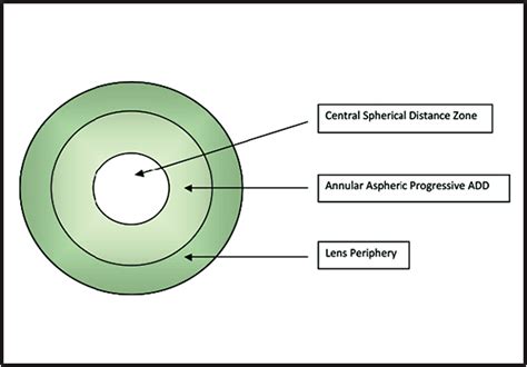 Contact Lens Spectrum Pentavision
