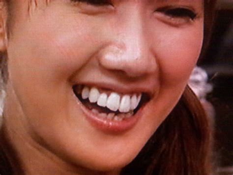 多岐川華子さんの前歯の画像 僕の審美歯科ガイド｜前歯の差し歯治療で後悔しないための情報源