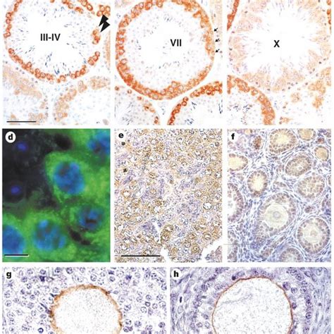 Testis Histology Genotypes Are As Described In The Legend To Fig 3