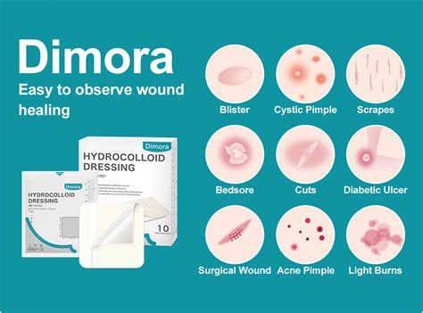 Hydrocolloid Bandages