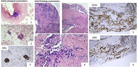 Microscopic Examinations Cytological And Immunocytochemical