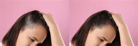 1 220 张 Before After Hairs Comparison 免版税图片、库存照片和图像 Shutterstock