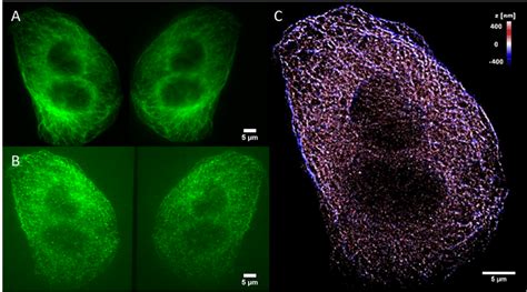 A Conventional Widefield Fluorescence Image From The Dual Objective