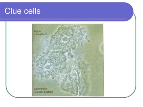 Rickettsia Chlamydia Mycoplasma Legionella And Gardnerellappt
