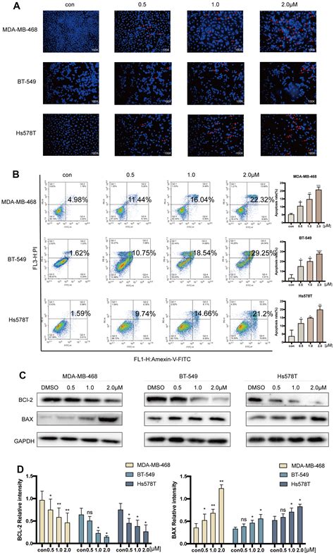 Acetyl Cinobufagin Suppresses Triple Negative Breast Cancer Progression