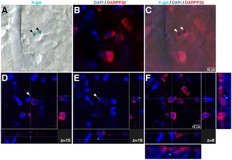 Comparison Between Light Transmitted Fluorescence Microscopy And Download Scientific Diagram