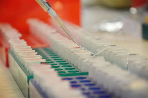 Extracting Rna 1920px Arc Training Centre For Future Crops Development
