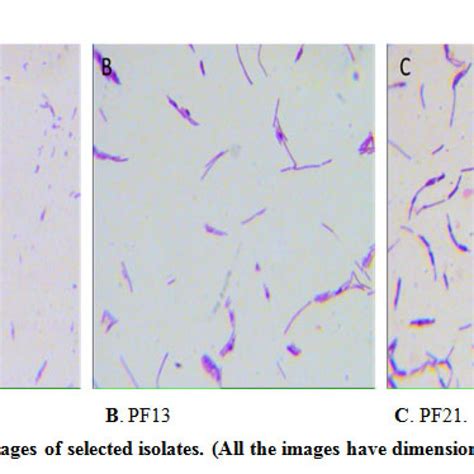 Characterization Of Alkaline Protease Producing Bacillus Halodurans Rscvs Pf21 Isolated From