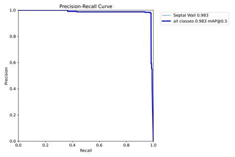 基于yolov8深度学习的心脏间隔壁检测与分割系统pyqt5界面数据集训练代码 中猿创新 7zcode