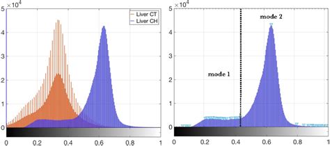 Figure 3 From Automated Unsupervised Segmentation Of Liver Lesions In