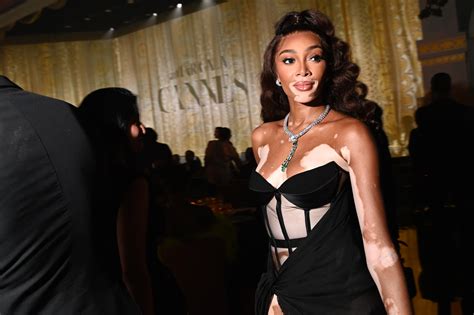 Where Are They Now Winnie Harlow