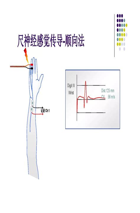 幻灯有约：肌电图基础