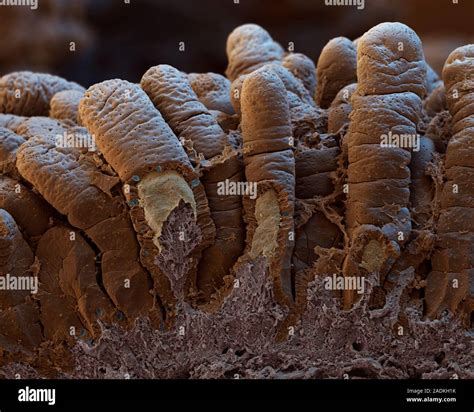 Small Intestine Villi Coloured Scanning Electron Micrograph Sem Of