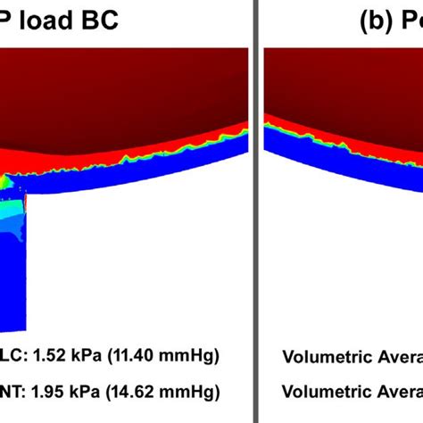 Contour Maps Of Pressure In The Donor 118 Fe Model In Sitting Body