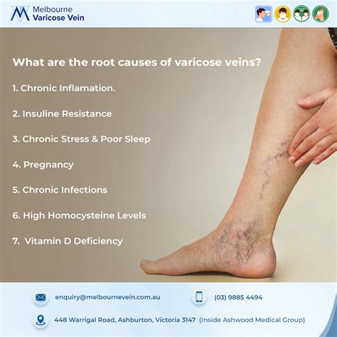 Melbourne Varicose Vein Melbourne Varicose Vein Clinic • Instagram Photos And Videos