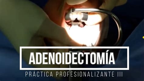 AdenoidectomÍa Youtube