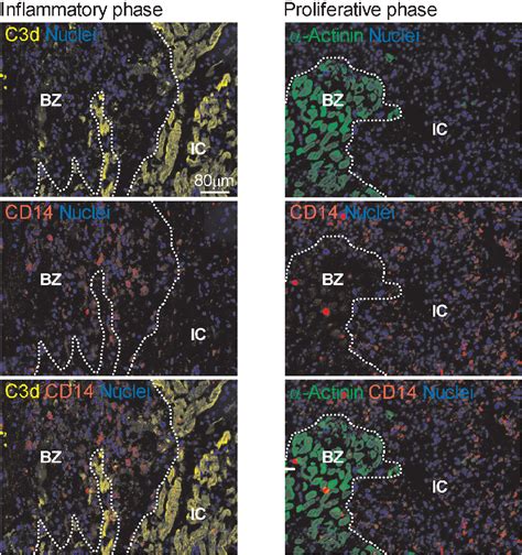 Figure From Monocyte Subset Accumulation In The Human Heart Following Acute Myocardial
