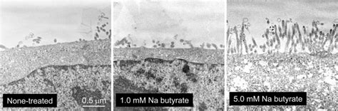 Caco 2 Cell Differentiation Into Intestinal Epithelium Like Cells By Na