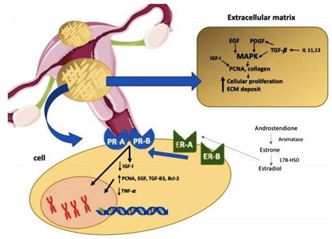 Functional Role Of Progesterone And Its Receptor In Uterine Leiomyoma