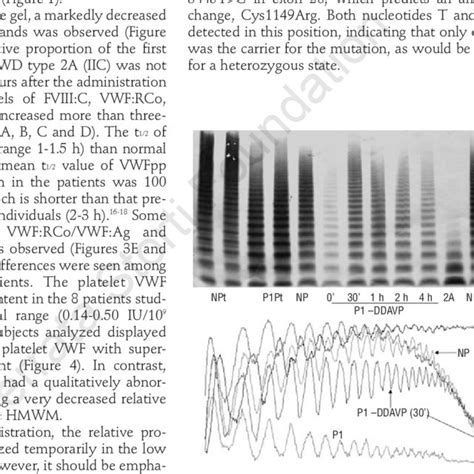 Multimeric Analysis Of Von Willebrand Factor Vwf In Platelets And