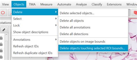 Cellpose Sam Qupath Extension Usage And Issues Imagesc Forum