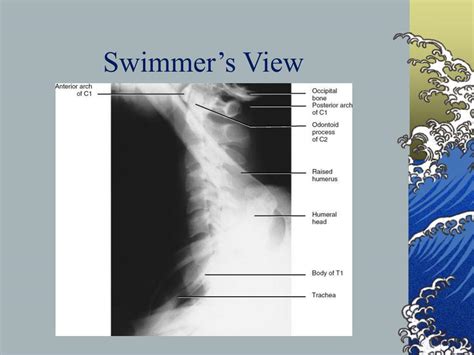 Swimmers View X Ray