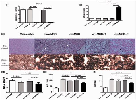 Sex Hormone Affects The Severity Of Non Alcoholic Steatohepatitis