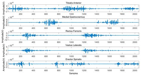 Sensors Free Full Text Locomotion Mode Recognition For Walking On Three Terrains Based On