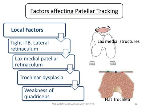 Patellofemoral Pain Syndrome Pfps